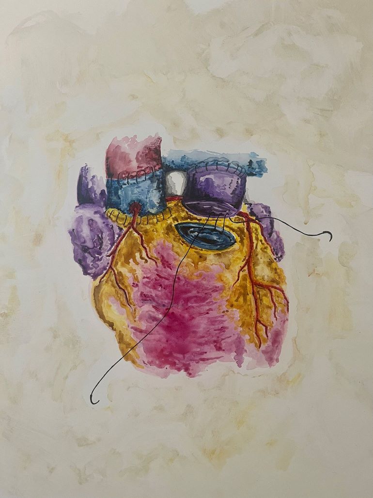 Ross Procedure Renaissance Widens Options for Patients - Mass General ...