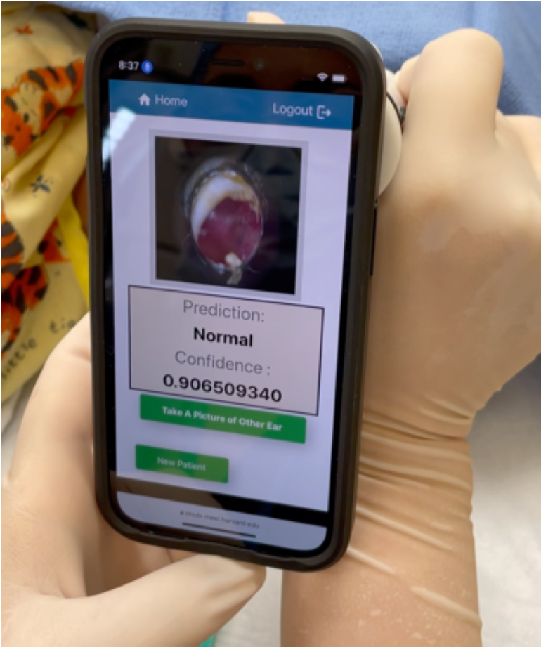 Artificial Intelligence Improves Diagnosis of Pediatric Middle Ear ...