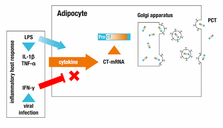 Procalcitonin and SARS-CoV-2 - Mass General Advances in Motion