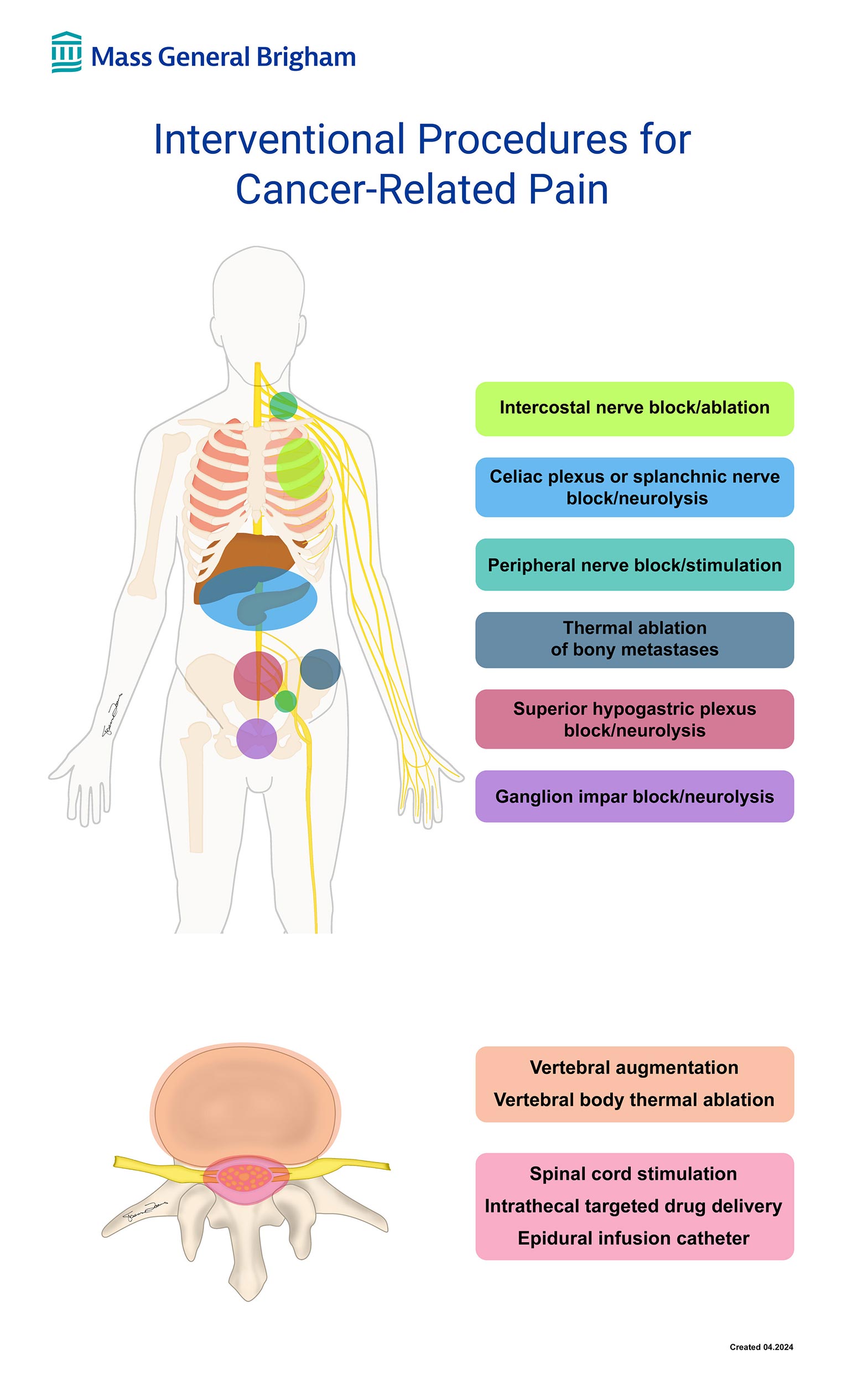 A Visual Reference for Cancer-related Pain and Associated Treatments ...