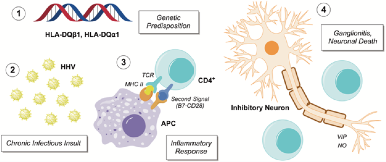 Pathways: Idiopathic Achalasia in the Setting of Autoimmune Disease ...