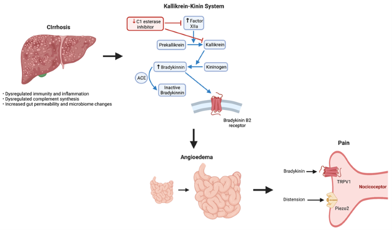 Pathways Case Record: A Patient With Cirrhosis and Small Bowel Edema ...