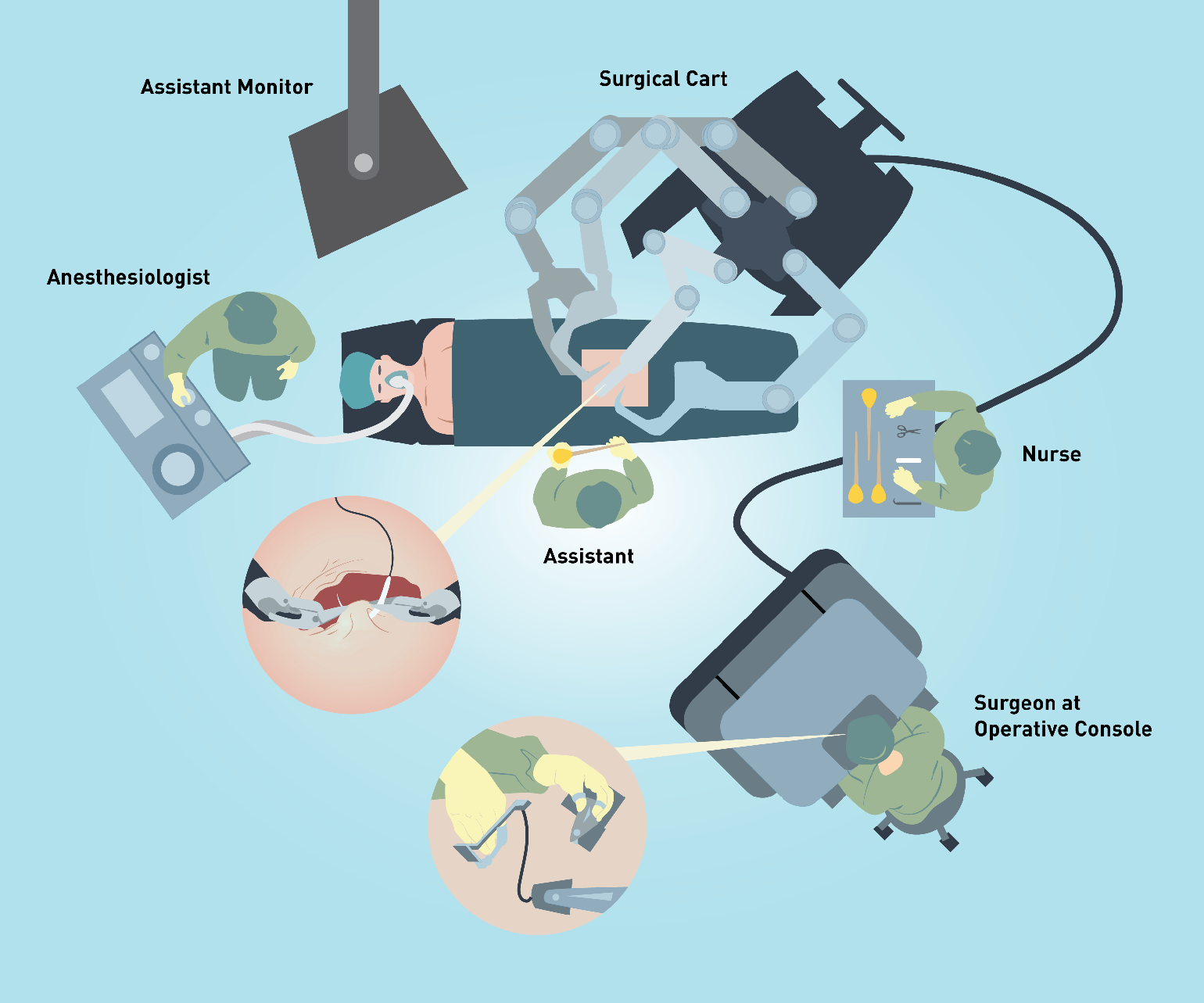 Advantages of Robot-assisted Techniques for Urologic Surgeries - Mass ...